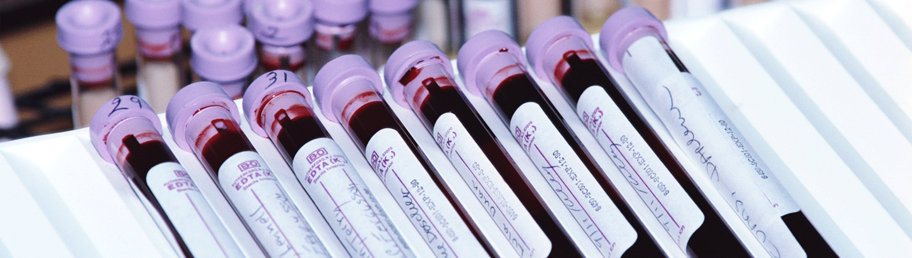 Solutions de contrôle - EuroTrol - HemoCue