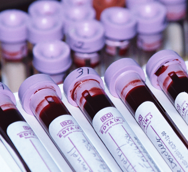 Solutions de contrôle - EuroTrol - HemoCue