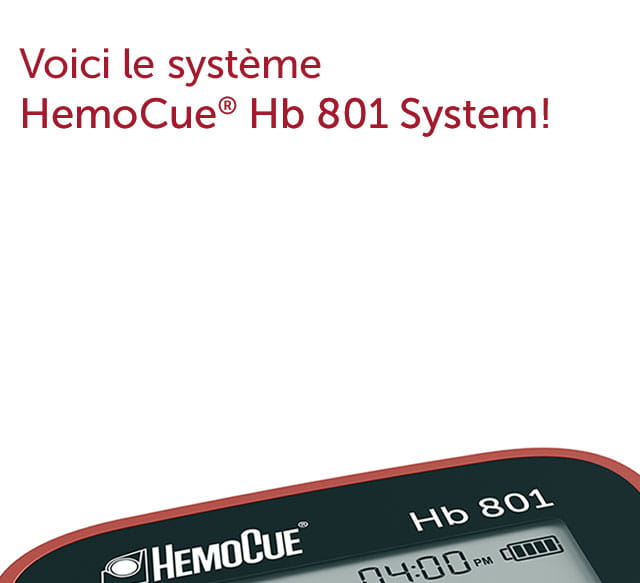 Définir la norme en matière de précision des tests sur le lieu d ...